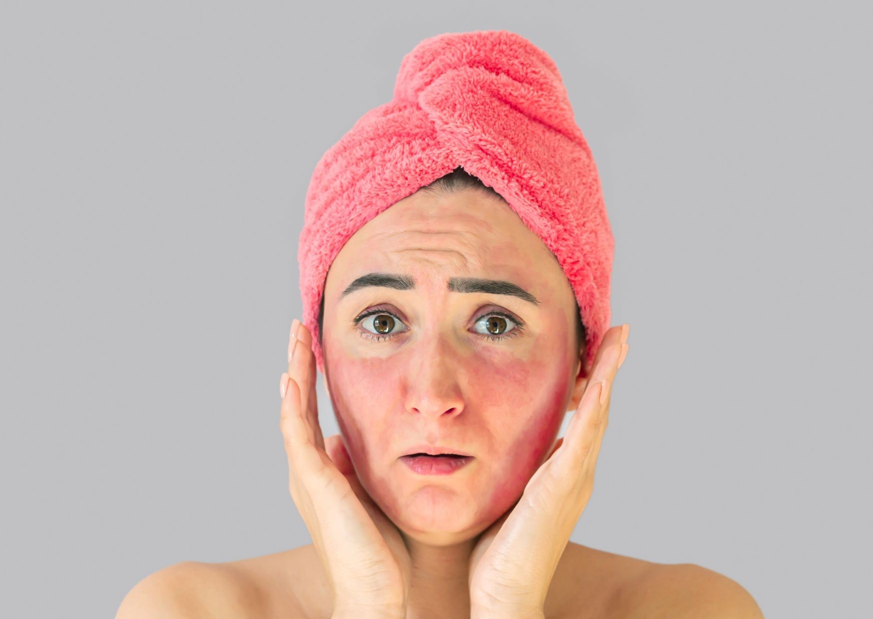 Comment calmer une peau irritée après un peeling - The Acné Cure